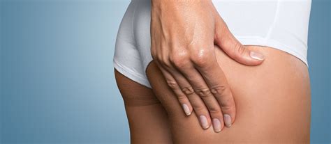 ¿qué Es La Celulitis