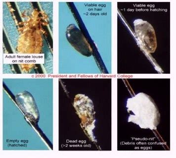 What Do Lice Eggs Look Like Lice Squad
