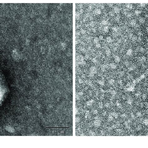 Tem Of Phages A Phage Pse D1 B Phage Pst H1 Download Tem Of Phages A Phage Pse D1 B Phage Pst H1 Download