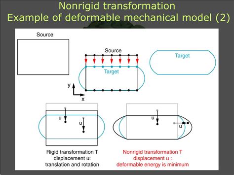 Ppt Image Registration And Application To Image Guided Neurosurgery Lara Vigneron Powerpoint