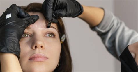 Scalp Micropigmentation For Scar Camouflage Magic Ink Smp