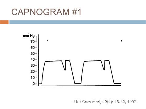 Etco2 In Non Intubated Patient A Must In Ed Ppt