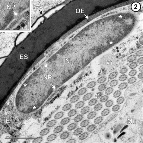 Details Of Three Egg Envelopes With The Nucleus And Perinuclear Region Download Scientific