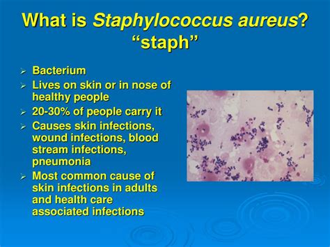 Staphylococcus Aureus Infection Antibiotic Treatment