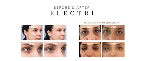 W Clinic Electri