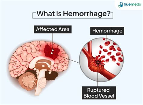 Судас тасрах гэмтэх Эмийн ургамал судлалын төв