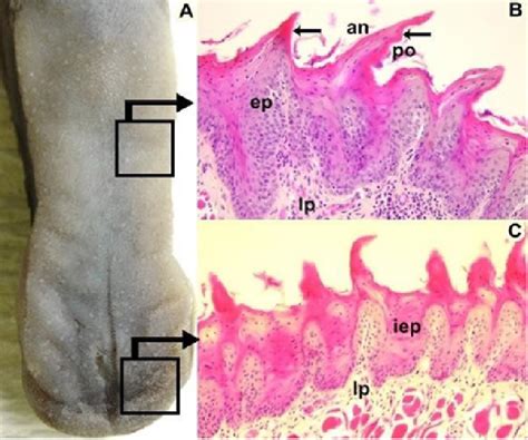 Filiform Papillae In Figure 233 Shows The Different Types Filiform