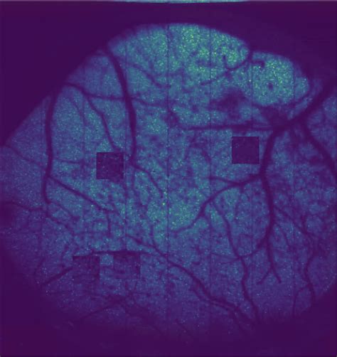 Porting Full FOV Stack Stitching Surface Maping To Mesoscope S