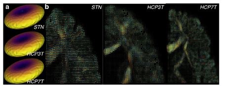 Estimated Fiber Orientation Distribution Functions Fodf A Examples Download Scientific