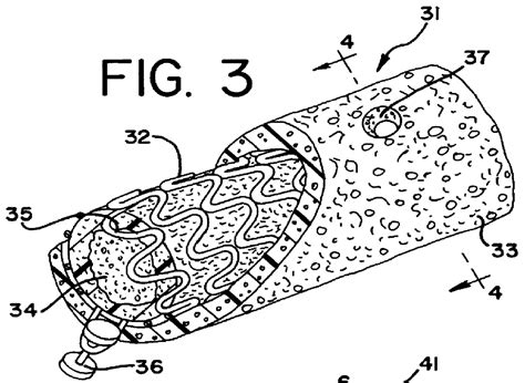 Expandable Supportive Endoluminal Grafts Eureka Patsnap