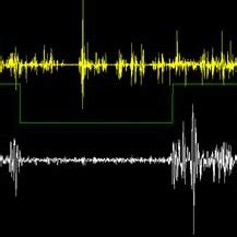 An Example Of Speech Detection Download Scientific Diagram