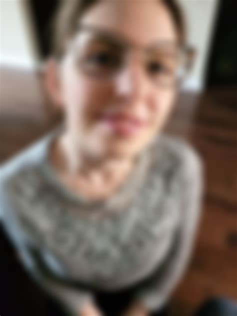 Oops Missed My Mouth A Bit Rfacials