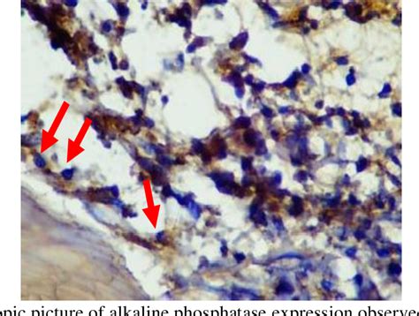 Figure 14 From Difference Between Bone Healing Process With The Use Of Demineralized Freeze