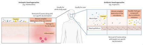 Staphylococcus Aureus Infection Treatment