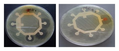 Susceptibility Pattern Of Bacterial Isolates Download Scientific Diagram