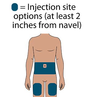 Clinical Implementation Of Yeztugo Lenacapavir For Prep │ Gilead