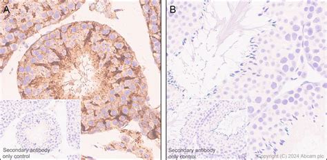 Anti Clusterin Beta Chain Antibody Epr17538 101 Ab184099 Abcam