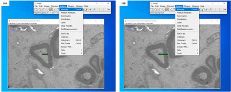A Screenshot To Explain The Measurement Of Length Of Calibrated Scale Download Scientific