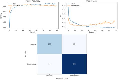 Result Of Vgg19 Model Accuracy Loss Curve And Confusion Matrix
