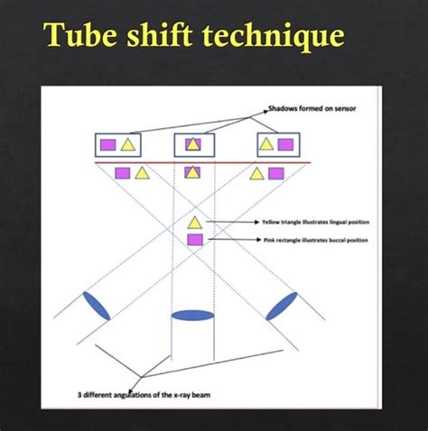 Radiology Object Localization Extra Oral Radiography And Advanced