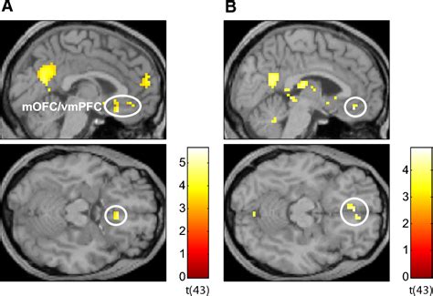 Figure 3 From Human Medial Orbitofrontal Cortex Is Recruited During Experience Of Imagined And