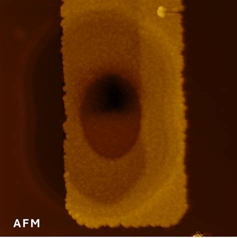 Correlative Microscopy News Qd Uk