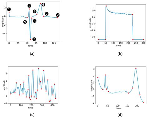 Interval Feature Transformation For Time Series Classification Using