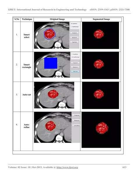 Interactive Liver Tumor Segmentation Using Pdf