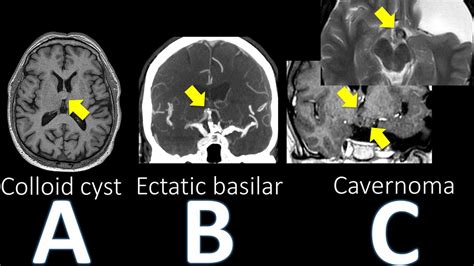 Thread By Teachplaygrub On Thread Reader App Thread Reader App