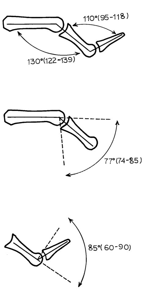 Median Range Of Motion Of The Control Osteotendinous Structure Above Download Scientific