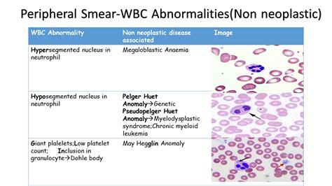 Wbc Abnormalitiesnon Neoplastic