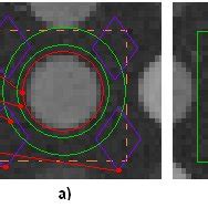 Méthodes de segmentation d image Microarray a Méthodes utilisées par Download Scientific