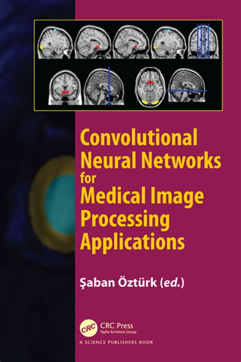 convolutional neural networks for medical image processing applications