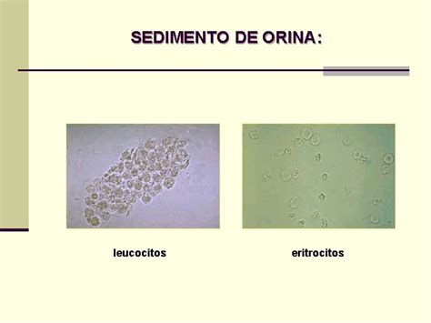 ORINA Dr Marcelo O Lucentini Qu Es La