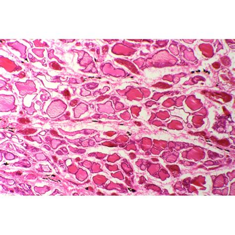 Simple Cuboidal Simple Cuboidal Epithelium By Science Photo Library