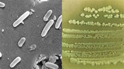 Enteropathogenic Escherichia Coli Epec Diseases Toxins Mode Of