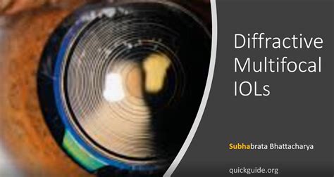 Understanding The Science Behind Diffractive Multifocal Iol