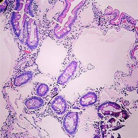 Pathology Gi Medizzy
