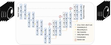 Figure 1 From Attention U Net Approach In Predicting Intensity Modulated Radiation Therapy Dose