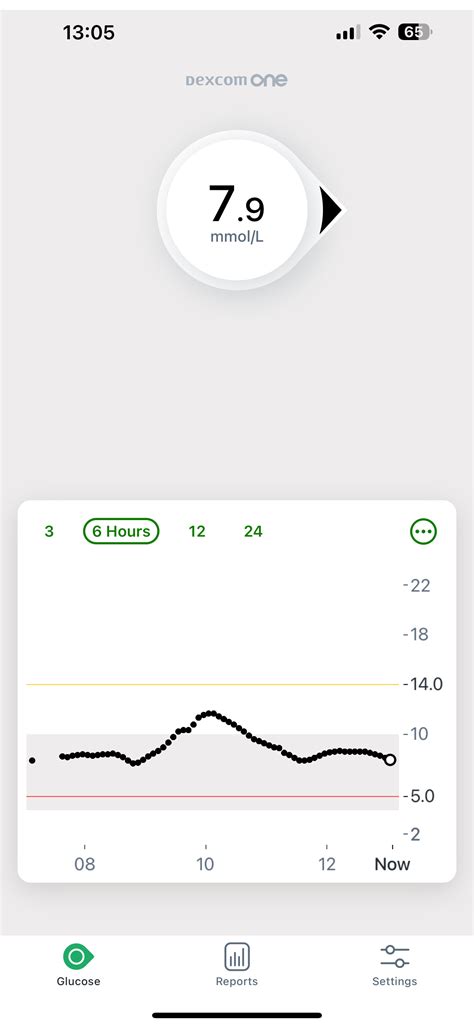 Brief Sensor Issues Missing Graph Dots And LOW Again Diabetes Forum The Global Diabetes