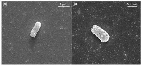 Detection Of Salmonella Typhimurium With Gold Nanoparticles Using Quartz Crystal Microbalance