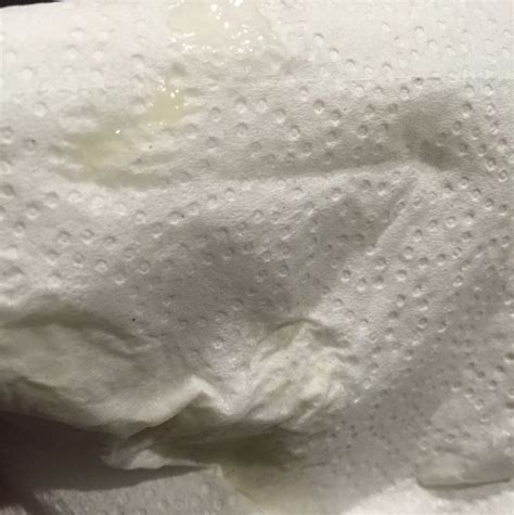 3dpo And Still Getting Jelly Cm Cant Be Leftover Sperm Because We Havent Bd Since Thursday