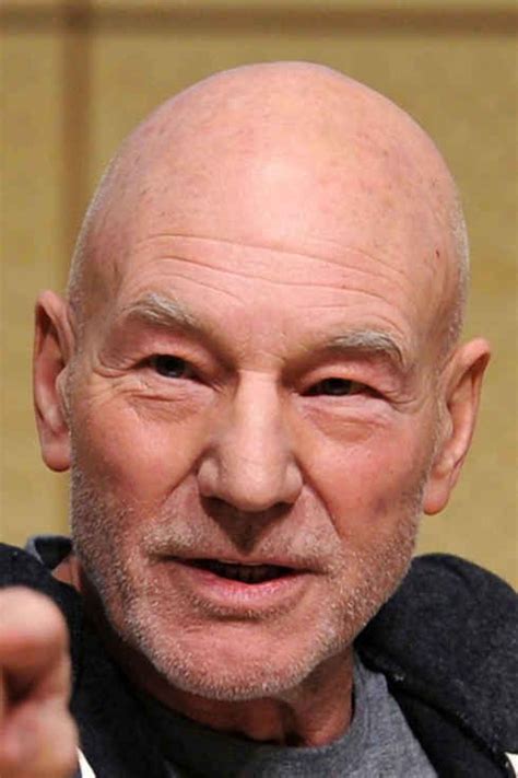 12 Eye Opening Pictures Of Bald Celebrities With Hair Balding Famous