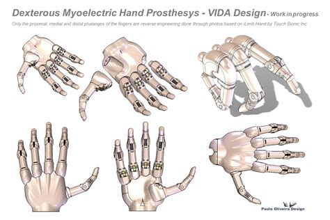 Dexterous Myoelectric Hand Prosthesis Vida Design Behance
