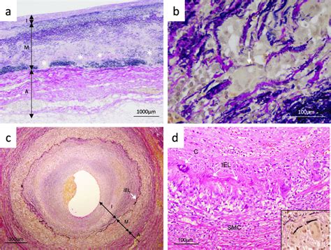 Large Vessel Vasculitis Download Scientific Diagram