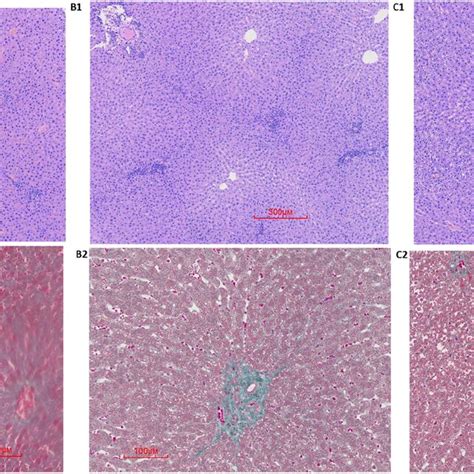Histological Assessment Of The Liver Using Hematoxylin And Eosin And Download Scientific
