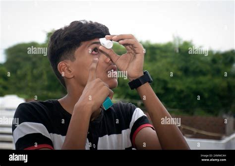 Eye Flu Acute Conjunctivitis Patient Asian Patient Has Red Eyes And