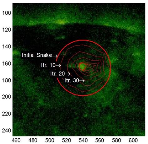 4 Detection Process Of A Selected Cbp 2010 10 5 Initial Contour