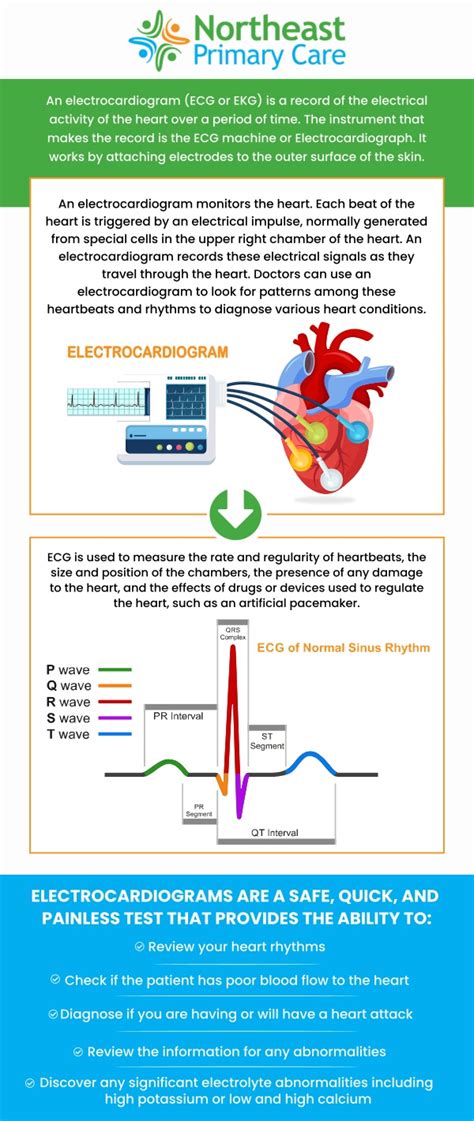 Electrocardiogram Diagram