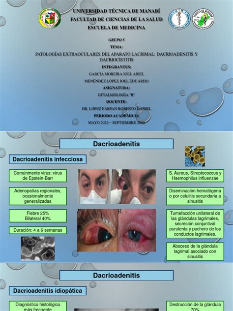 Grupo 5 Diapositivas Dacrioadenitis Y Dacriocistitis Pdf Inflamación Especialidades Medicas